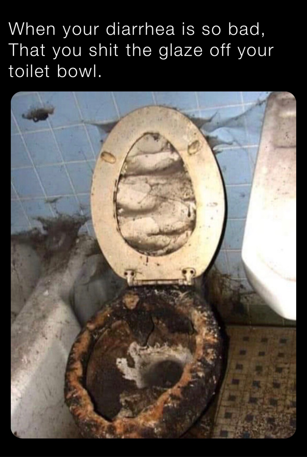 You Shit