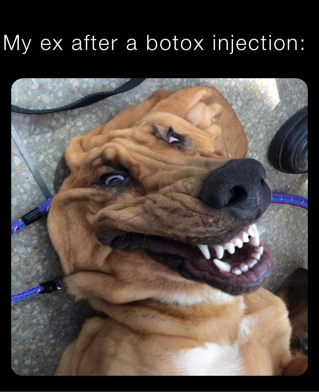 My ex after a botox injection: | @Vychod_radek | Memes