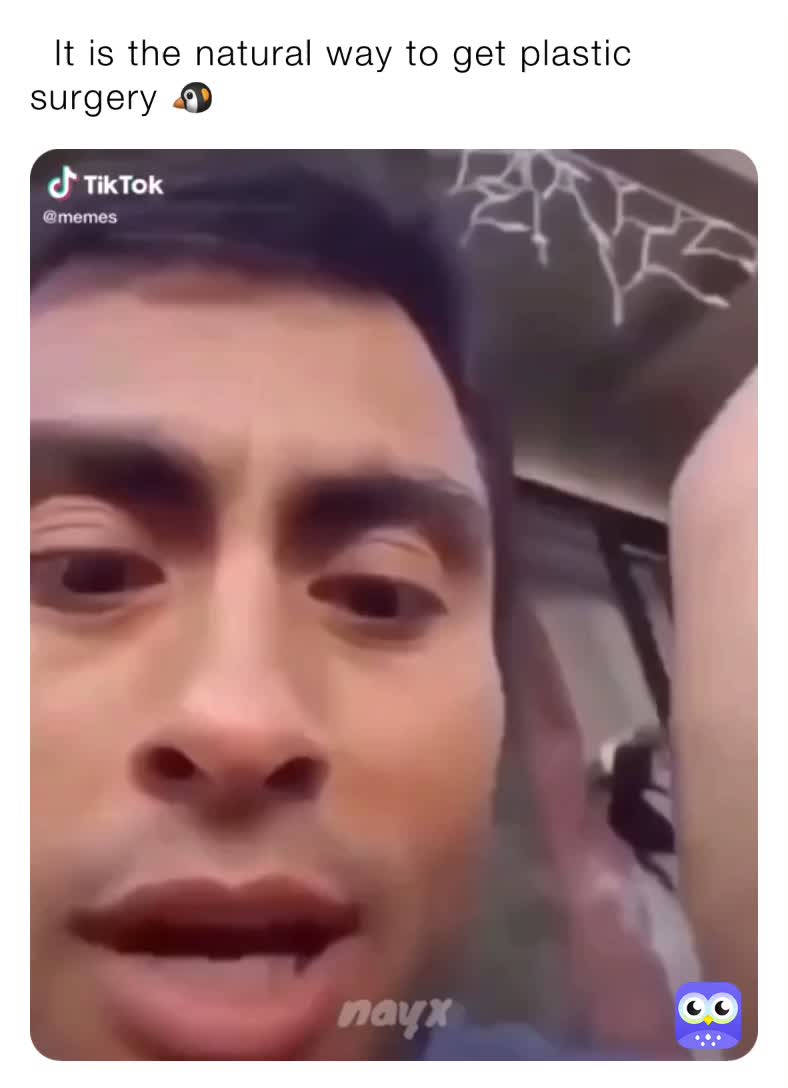 It is the natural way to get plastic surgery 🐧 | @LaughToMeme | Memes