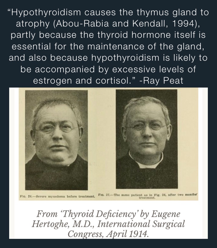 “Hypothyroidism causes the thymus gland to atrophy (Abou-Rabia and ...