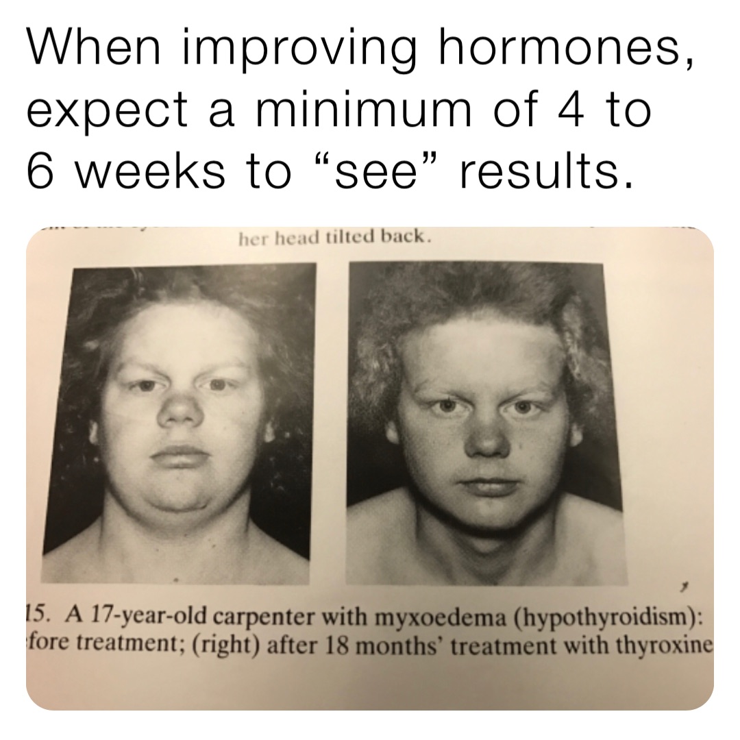 When improving hormones, expect a minimum of 4 to 6 weeks to “see ...